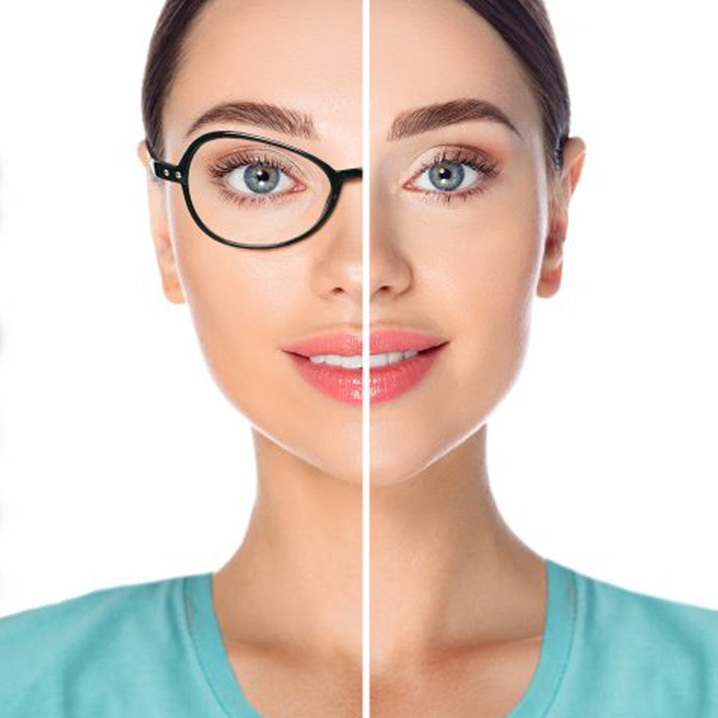 Contoura Vision Lasik